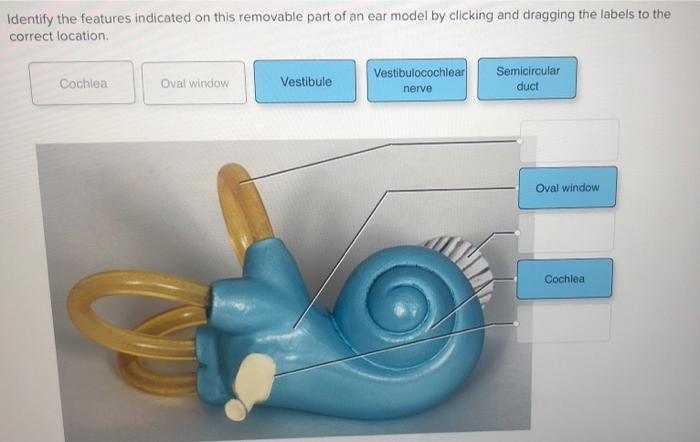 Solved Identify the features indicated on this removable | Chegg.com