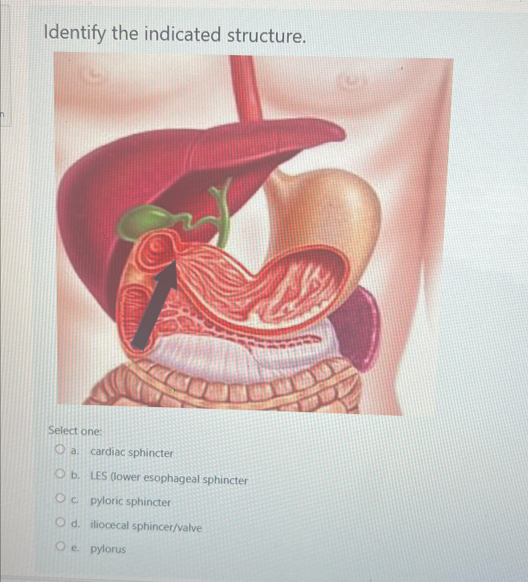 Solved Identify the indicated structure.Select one:a. | Chegg.com