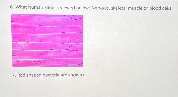 Solved 6. What human slide is viewed below: Nervous, | Chegg.com
