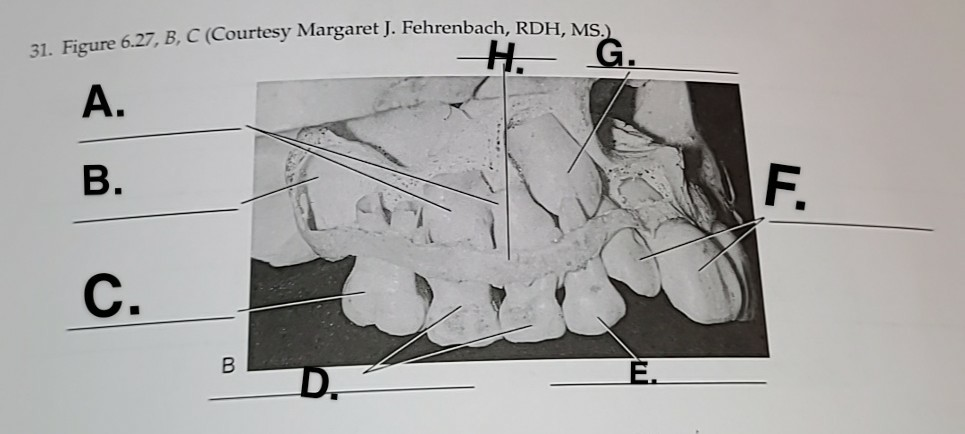 Solved Label Mixed Dentition figure 6.27, b, c (courtesy | Chegg.com