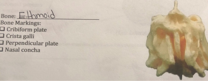 Solved Bone: Ethmoid Bone Markings: Cribiform plate Crista | Chegg.com