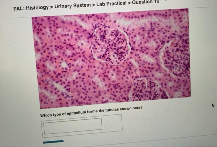 Solved PAL: Histology > Urinary System > Lab Practical > | Chegg.com