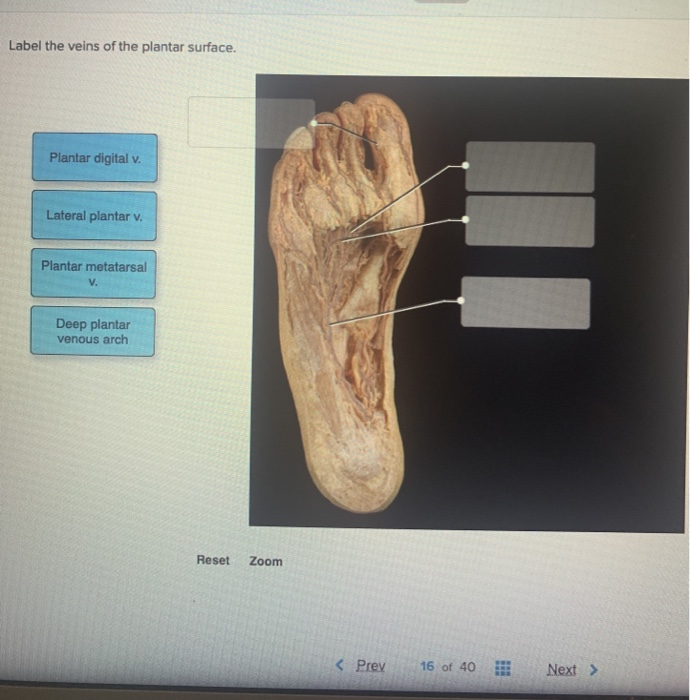 Solved Label the veins of the plantar surface. Plantar | Chegg.com