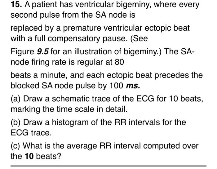 Solved 15. A patient has ventricular bigeminy, where every | Chegg.com