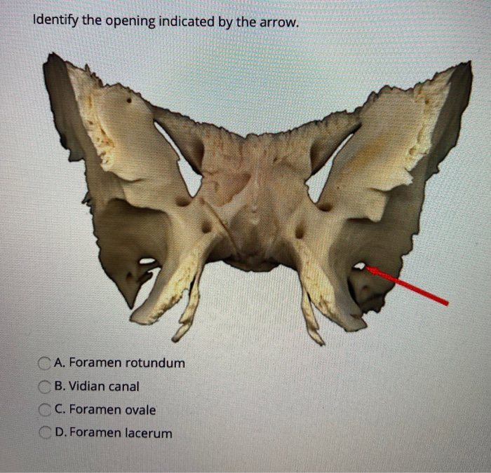 Solved Identify the opening indicated by the arrow. CA. | Chegg.com