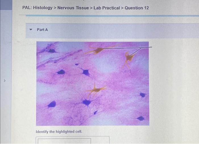 Solved PAL: Histology > Muscular Tissue > Lab Practical > | Chegg.com
