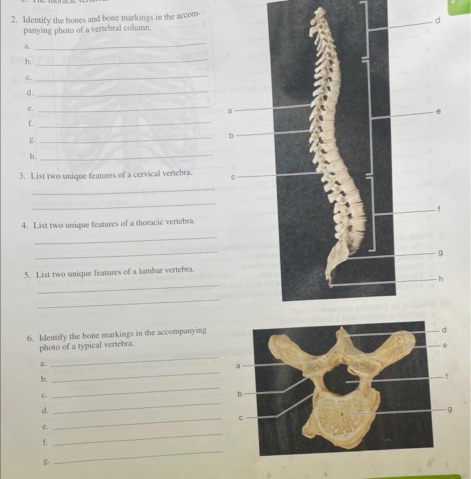 Solved 2. Identify the bones and bone markings in the | Chegg.com