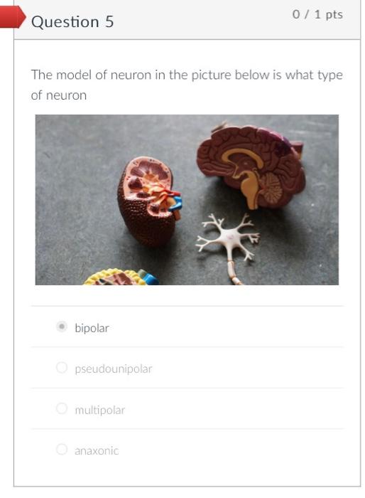 Solved What Kind Of Innervation Does The Organ Below Have