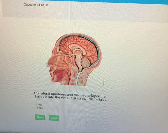 Solved Question 31 of 50 The lateral apertures and the | Chegg.com