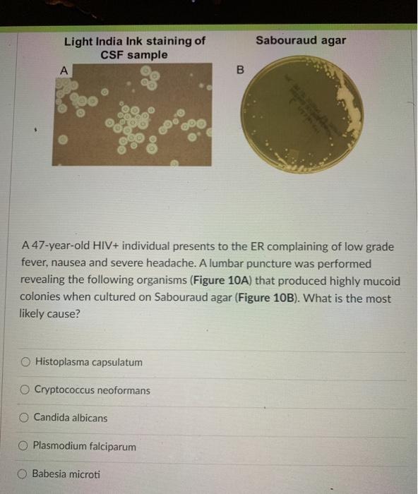 Solved Sabouraud agar Light India Ink staining of CSF sample | Chegg.com