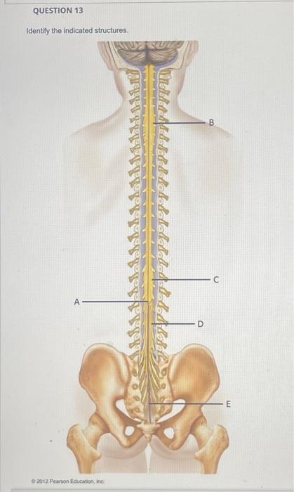 Solved Identify the indicated structures. | Chegg.com