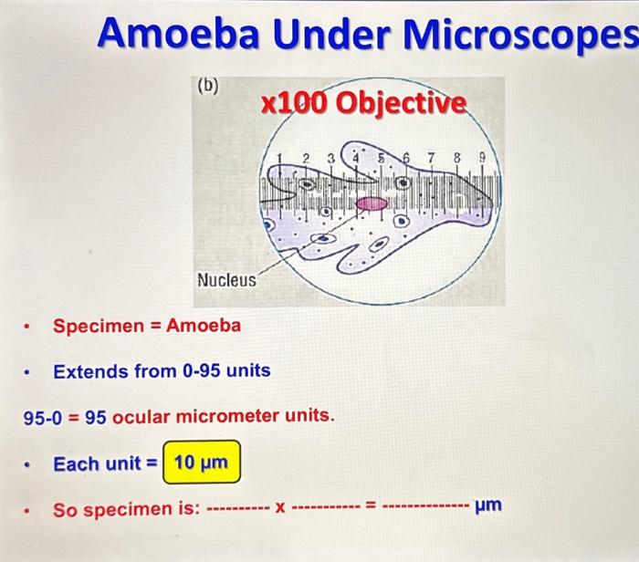 Solved Amoeba Under Microscopes - Specimen = Amoeba - | Chegg.com