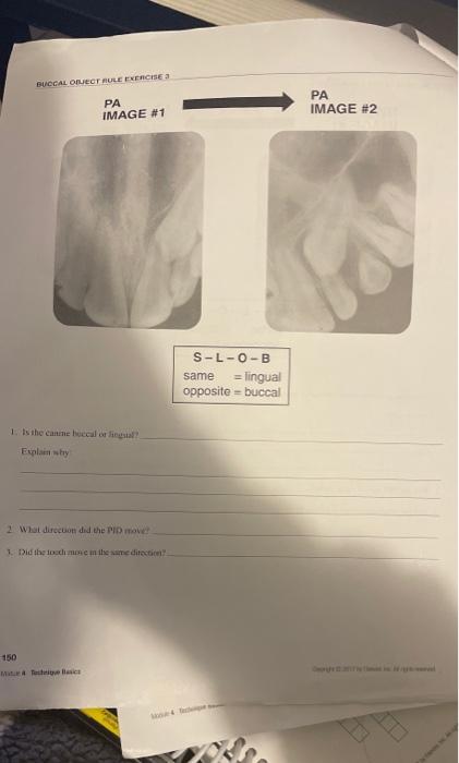 Solved BUCCAL OIECT RULE TERCISES PA IMAGE #1 PA IMAGE #2 | Chegg.com