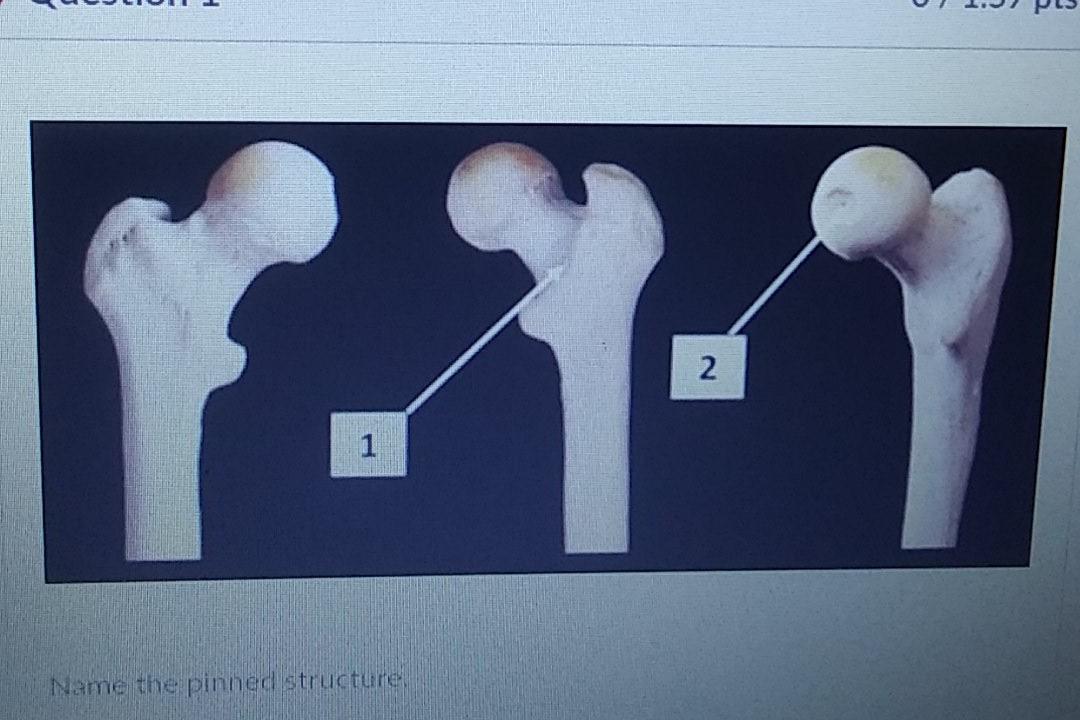 Solved 2 Name the pinned structure Linea.alba Linea aspera | Chegg.com