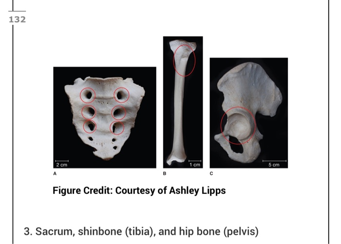 Solved 3. Examine the sacrum, shinbone (tibia), and hip bone | Chegg.com