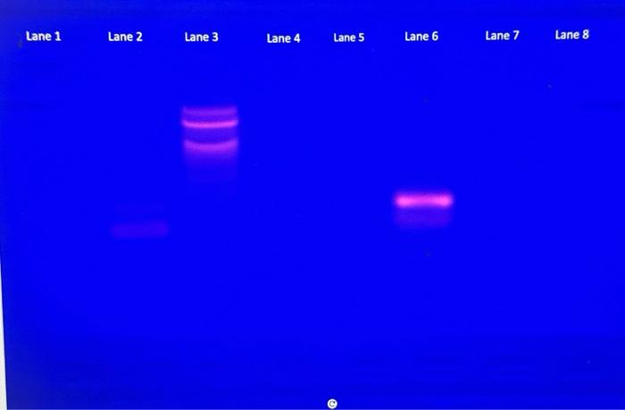 Lane 1 Lane 2 Lane 3 Lane 4 Lane 5 Lane 6 Lane 7 Lane | Chegg.com