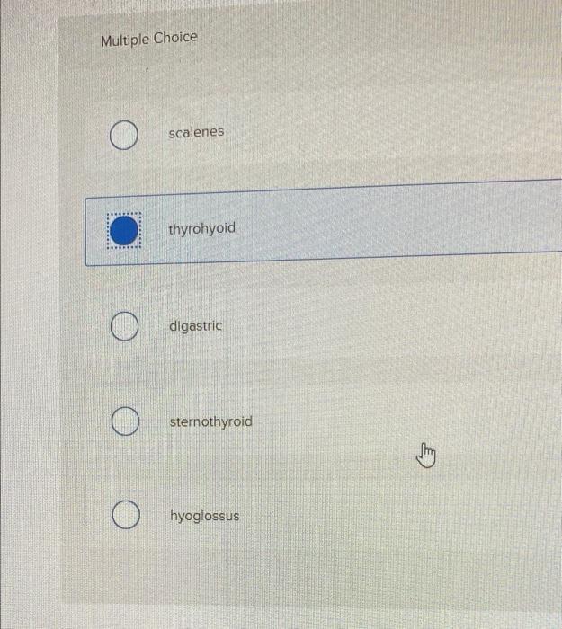 Solved Which structure is highlighted? Multiple Choice O | Chegg.com