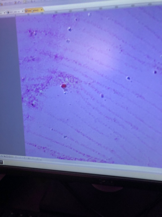 CONVENTIONAL GRAM STAIN Reagent preparation Crystal | Chegg.com