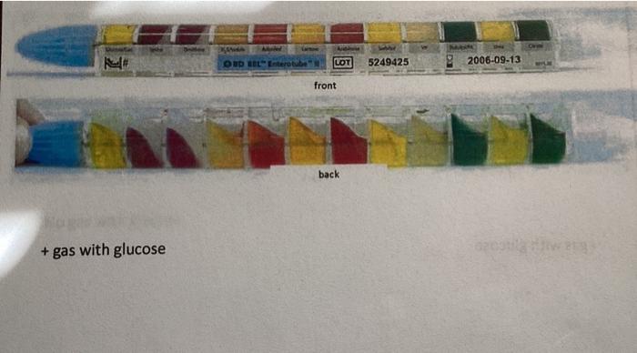 [Solved]: Microbiology EnteroPluri-Test Circle the number co