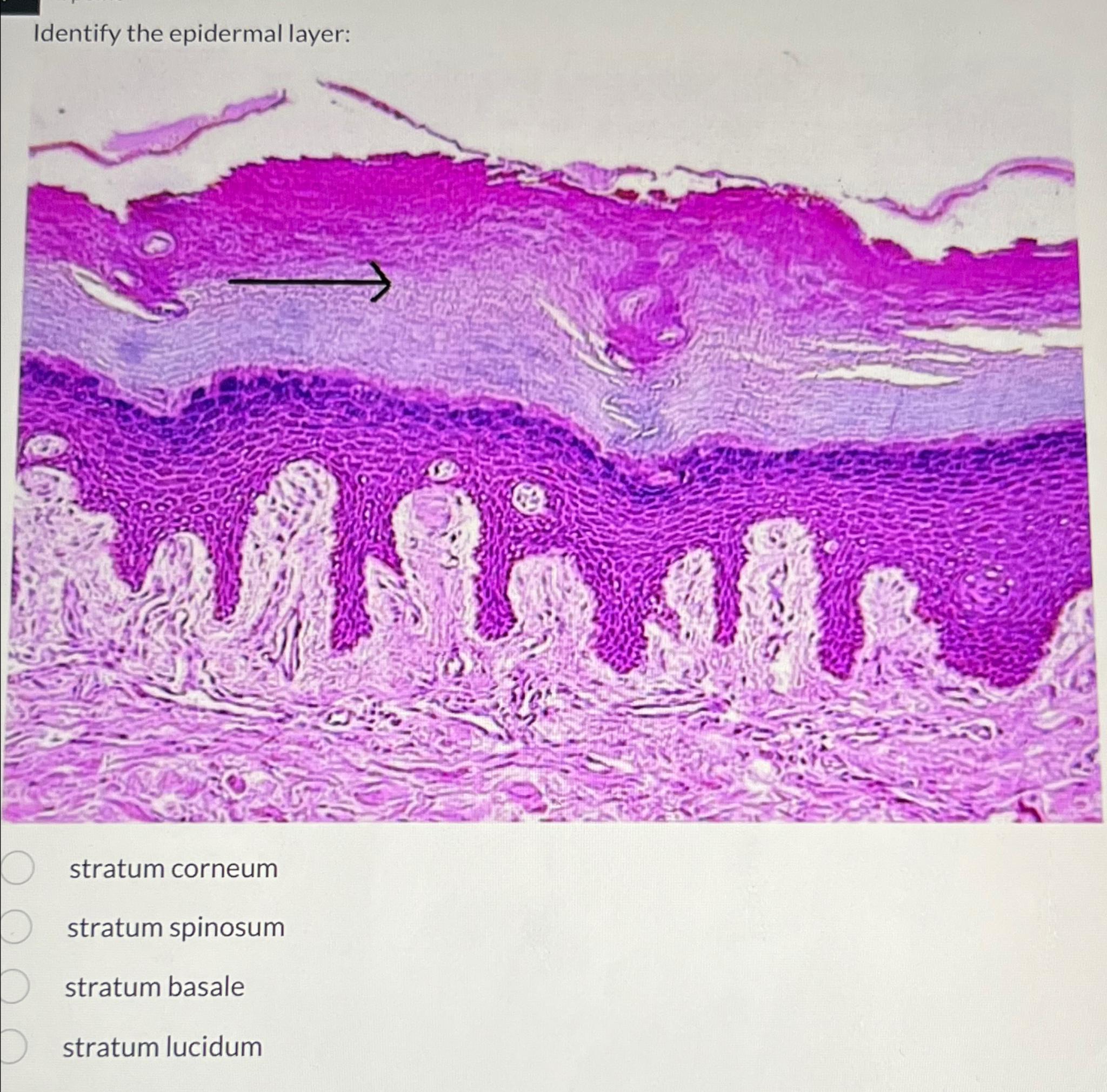 Solved Identify the epidermal layer:stratum corneumstratum | Chegg.com