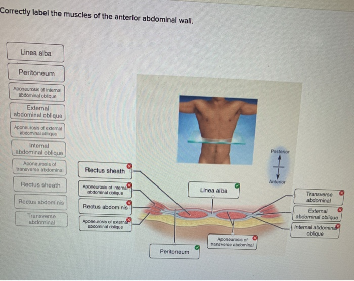 Solved Correctly label the muscles of the anterior abdominal | Chegg.com