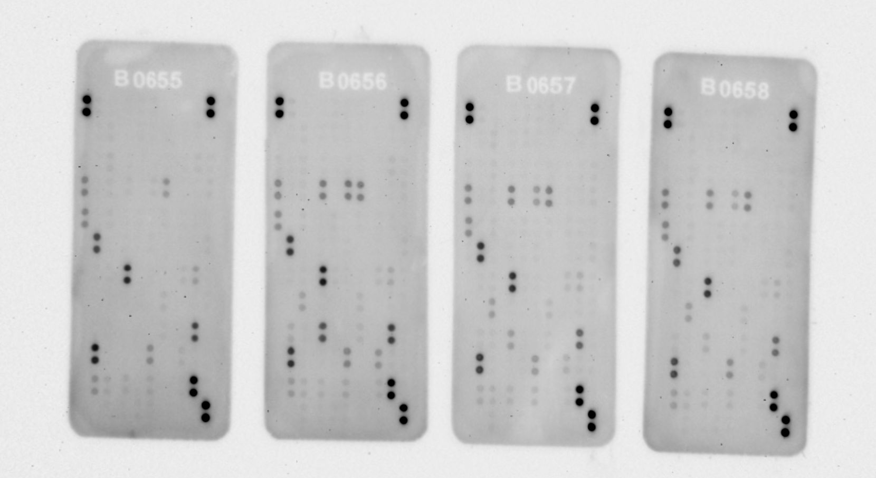 Solved Here is my cytokine array result. I used the kit from | Chegg.com