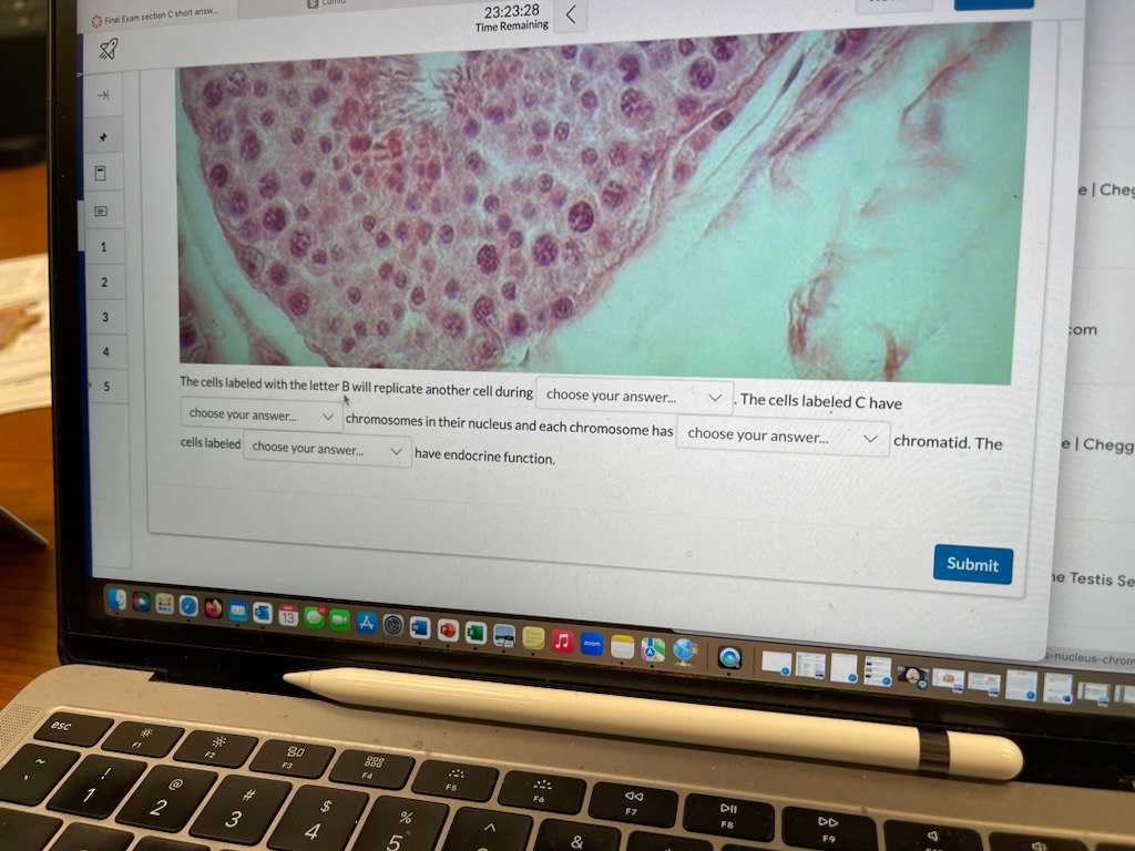 Solved The cells labeled with the letter B will replicate | Chegg.com