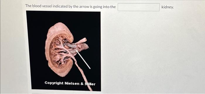 Solved The blood vessel indicated by the arrow is going into | Chegg.com