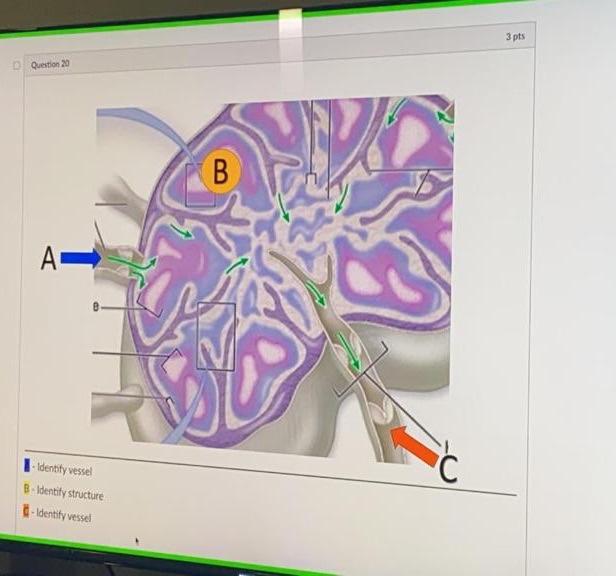 Solved 3 pts Question 20 B A Identity vessel B-Identity | Chegg.com