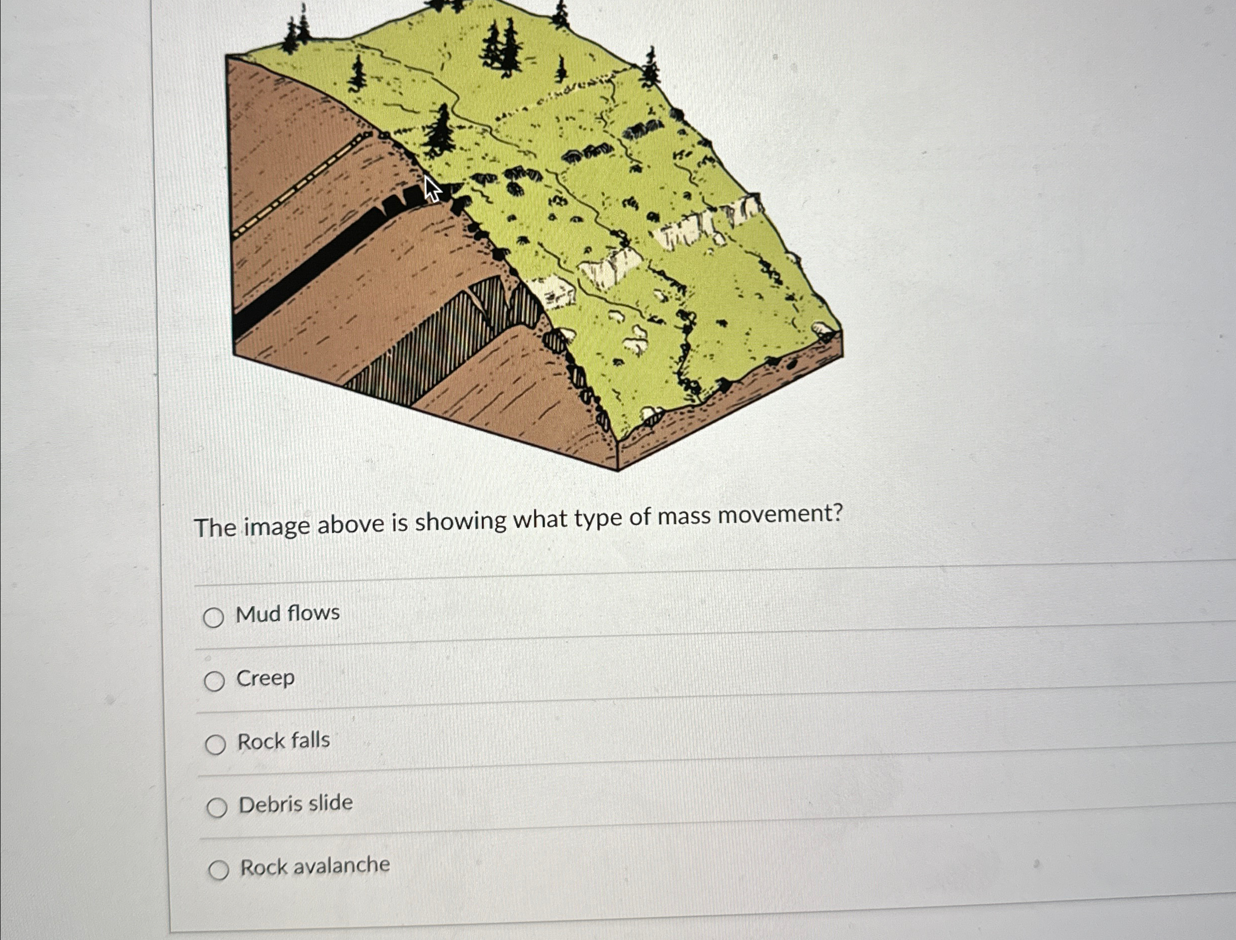 Solved The image above is showing what type of mass | Chegg.com