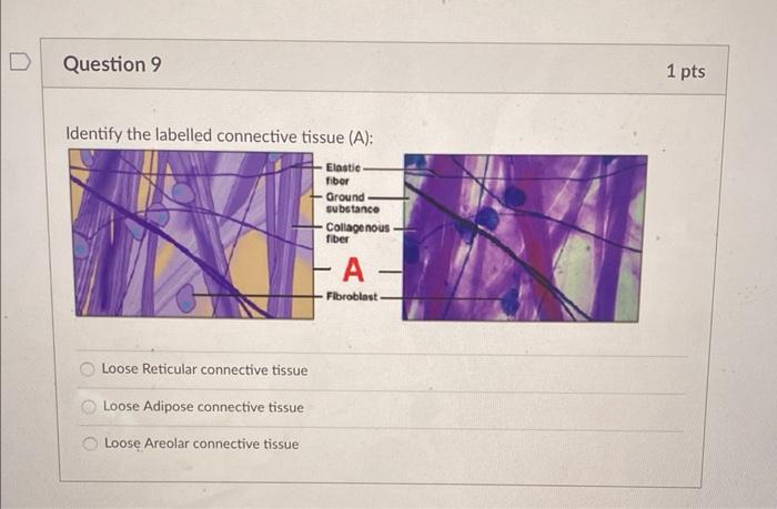 Solved Identify the labelled connective tissue (A): Loose | Chegg.com