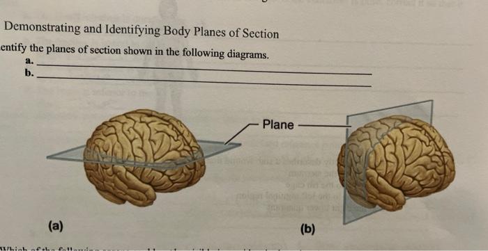 Solved Demonstrating and Identifying Body Planes of Section | Chegg.com