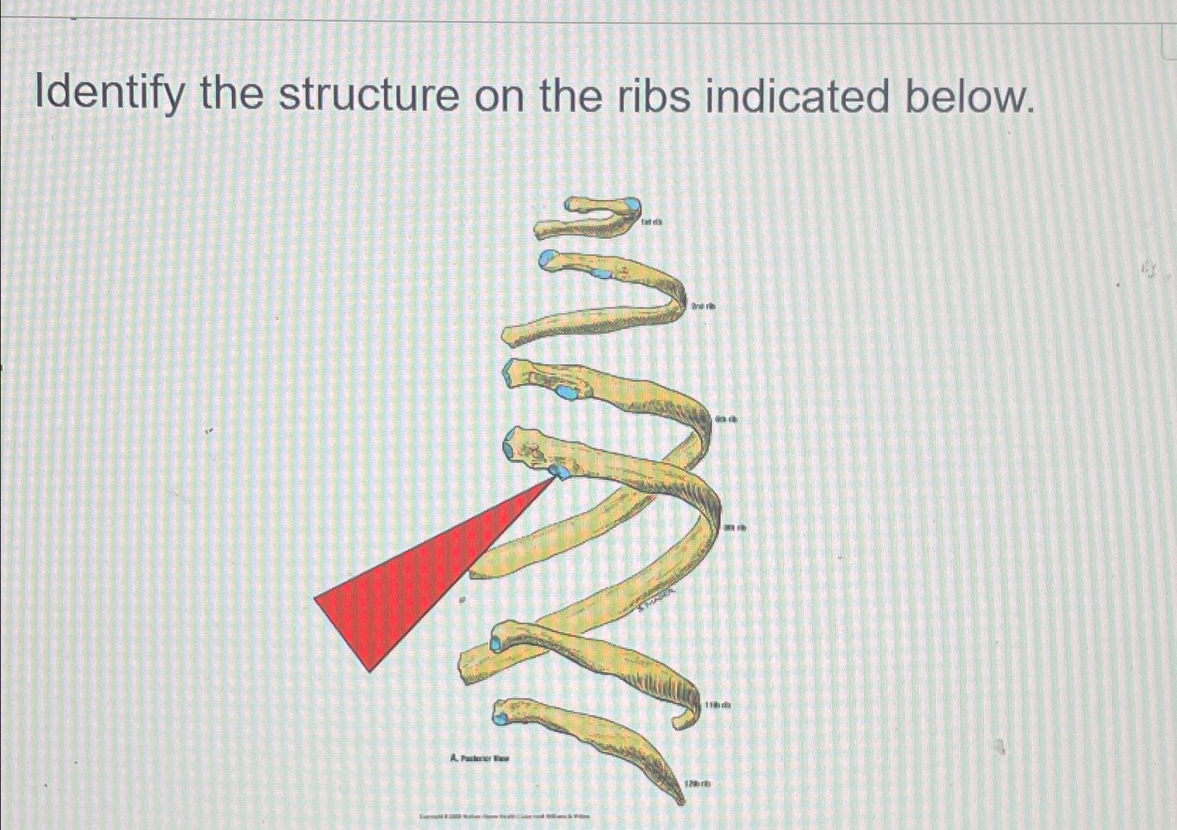 Solved Identify the structure on the ribs indicated below. | Chegg.com
