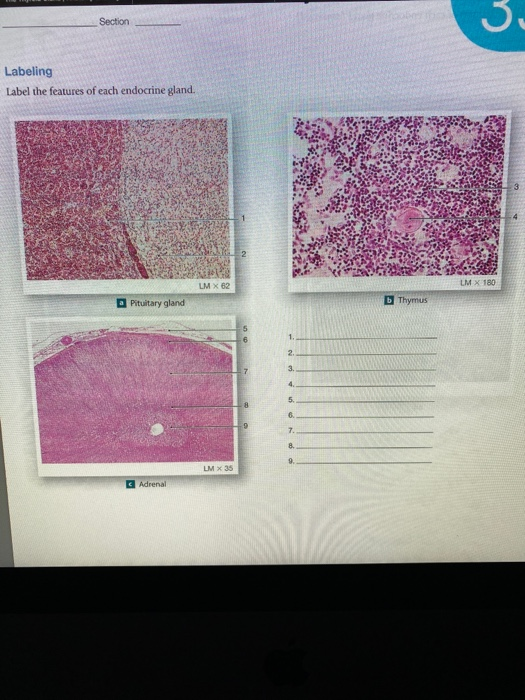 Solved Section Labeling Label the features of each endocrine | Chegg.com