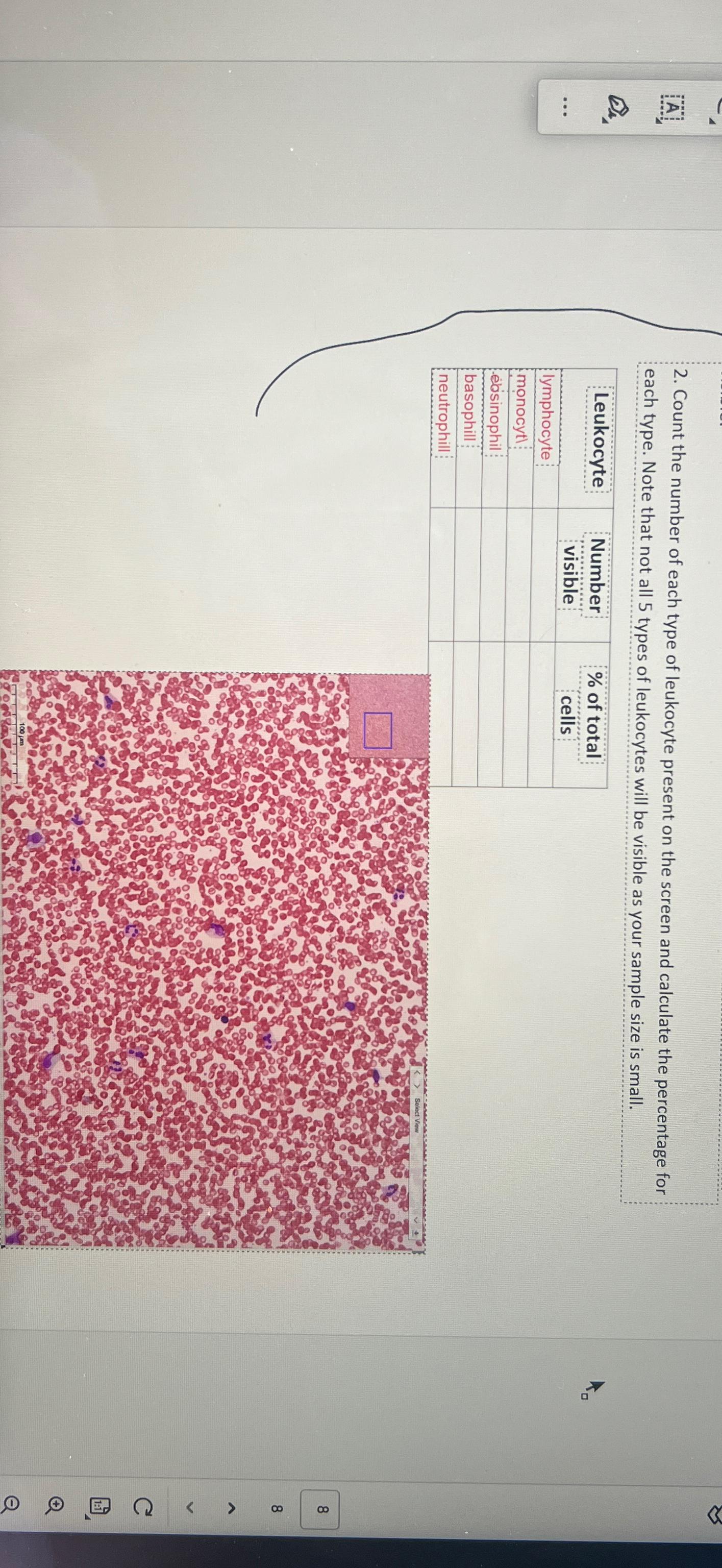Solved Count the number of each type of leukocyte present on | Chegg.com