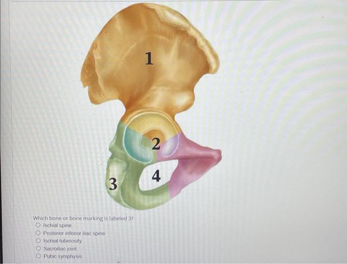 Solved Which bone or bone marking is labeled 3 ? ischial | Chegg.com