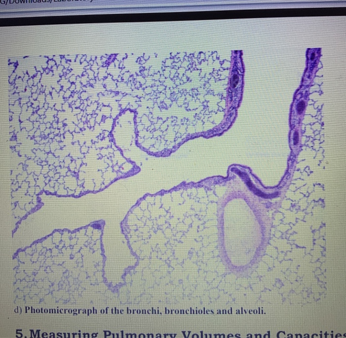 Solved d) Photomicrograph of the bronchi, bronchioles and | Chegg.com
