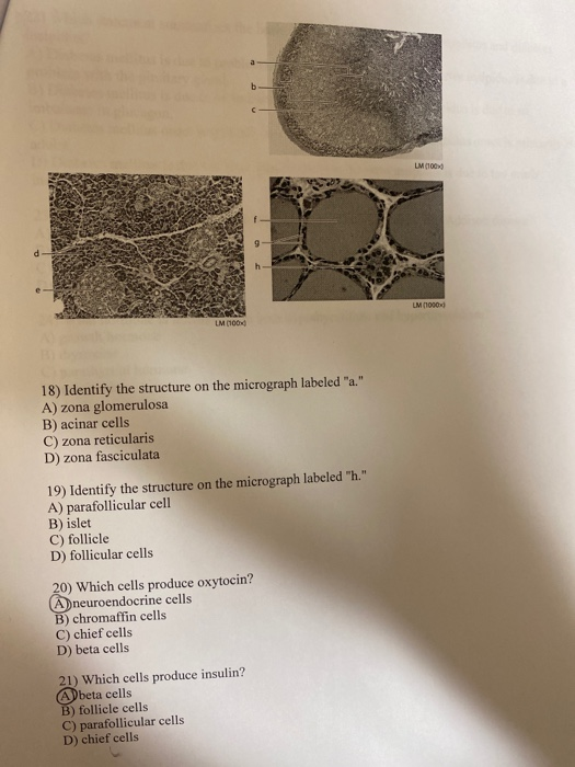 Solved LM 00 18) Identify the structure on the micrograph | Chegg.com