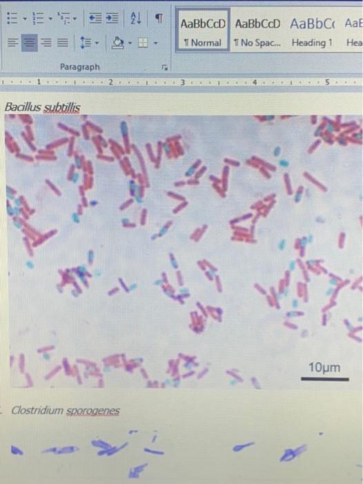 Solved Lab Report 4: The Endospore Stain Name: Team: Due on | Chegg.com