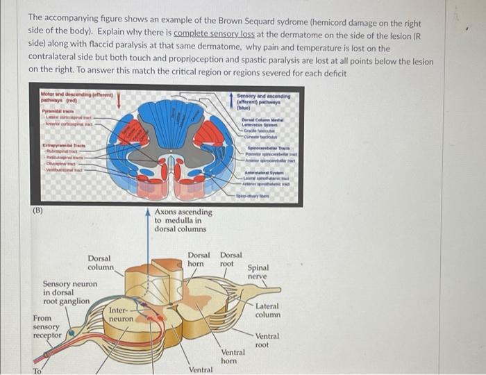 Solved The accompanying figure shows an example of the Brown | Chegg.com