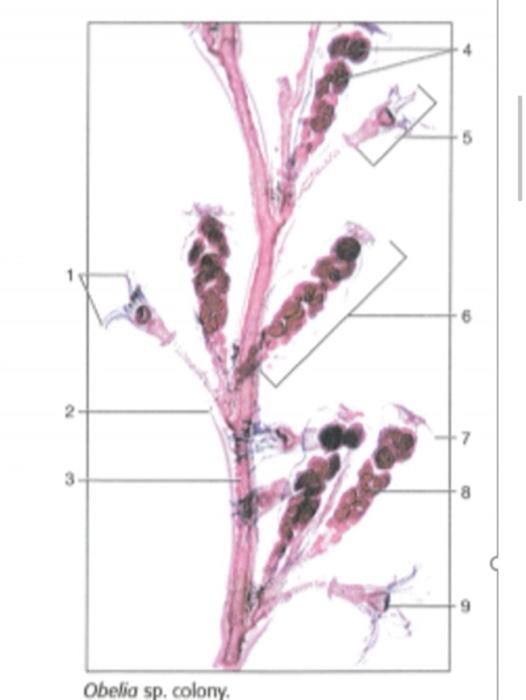 Solved 6 2 7 8 Obelia sp. colony Phylum Cnidaria Class | Chegg.com