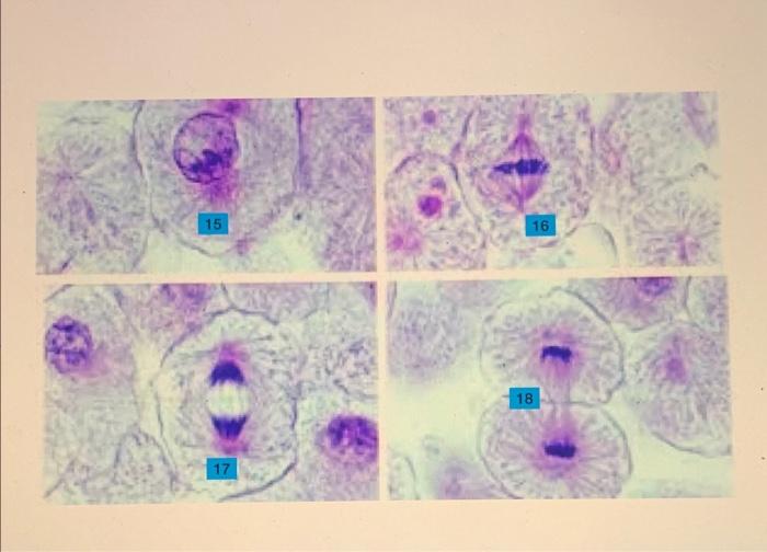 Solved cell division- label it | Chegg.com