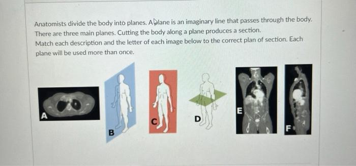 Anatomists divide the body into planes. Aplane is an | Chegg.com