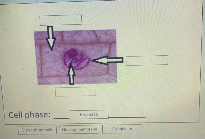 Solved Cell phase: Interphase cell wall nuclear membrane | Chegg.com