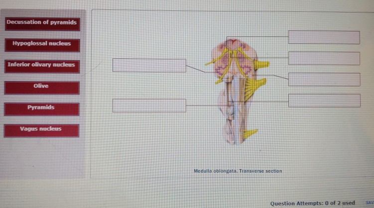 Solved Decussation of pyramids Hypoglossal nucleus Inferior | Chegg.com