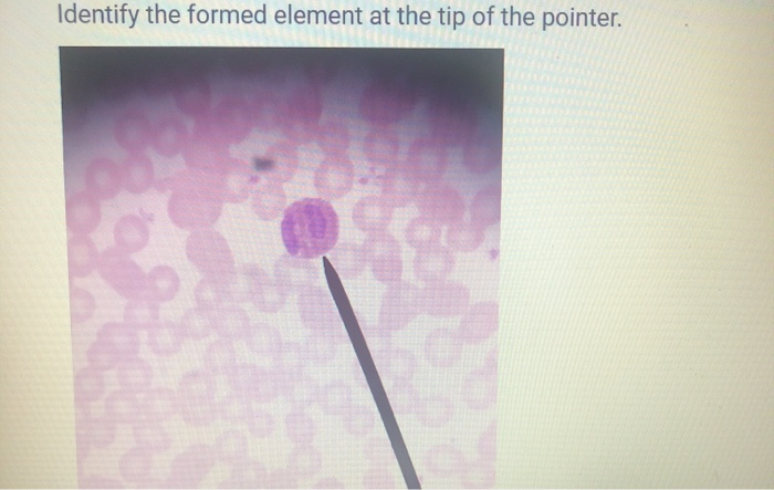 Solved Identify the formed element at the tip of the | Chegg.com