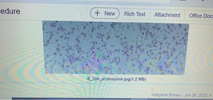 Solved Endospore slides: You will see the name of the | Chegg.com