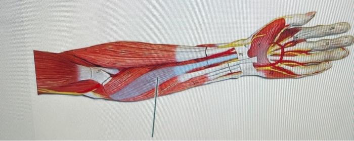 Solved identify the highlighted muscle | Chegg.com