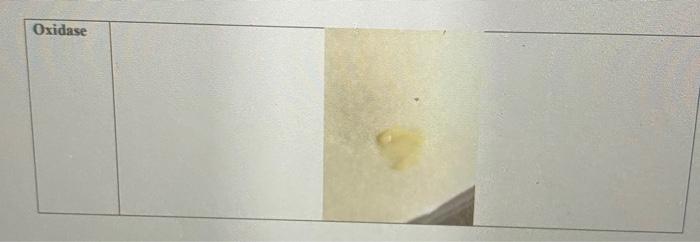 Unknown Bacteria Data Sheet Your unknown bacteria | Chegg.com