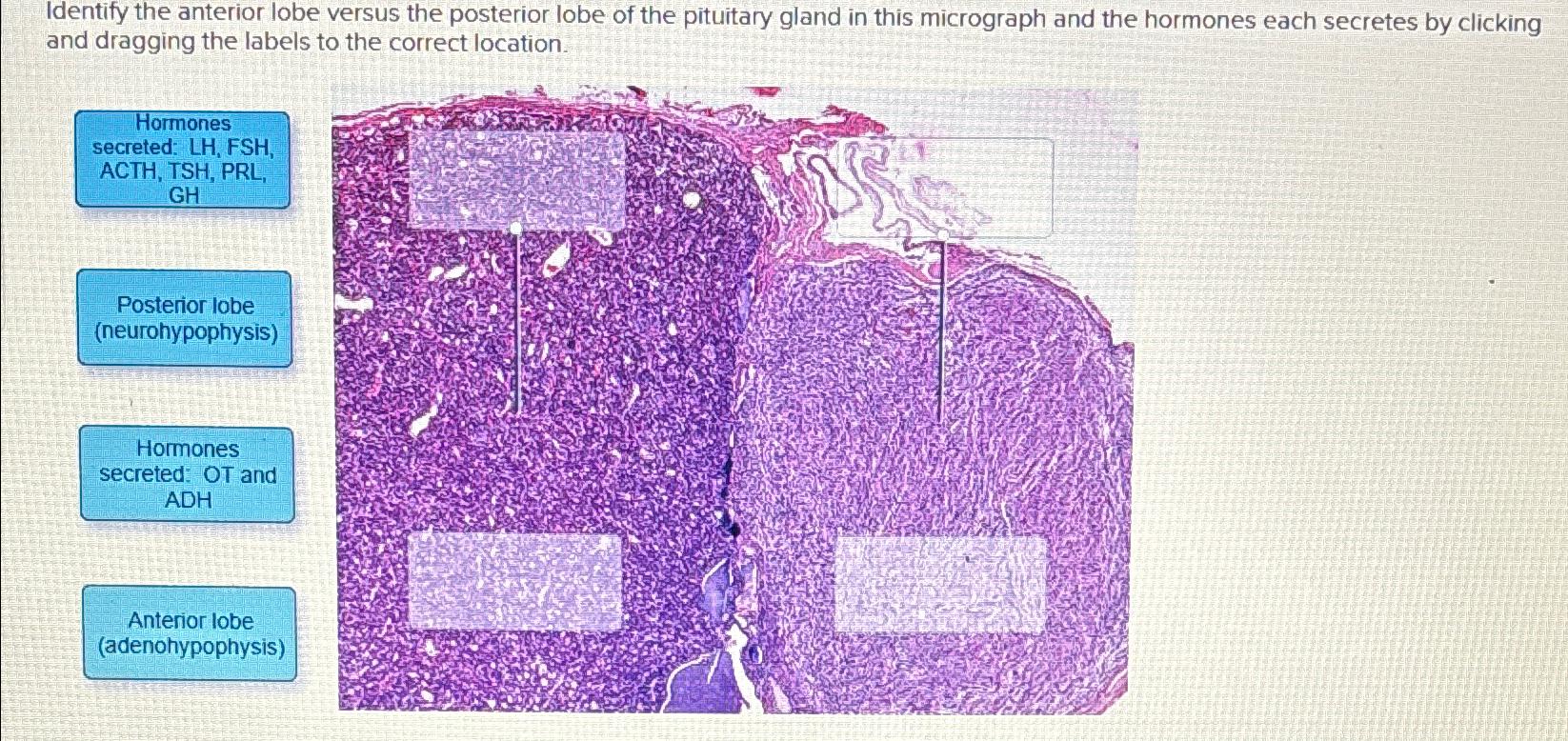 Solved Identify The Anterior Lobe Versus The Posterior Lobe